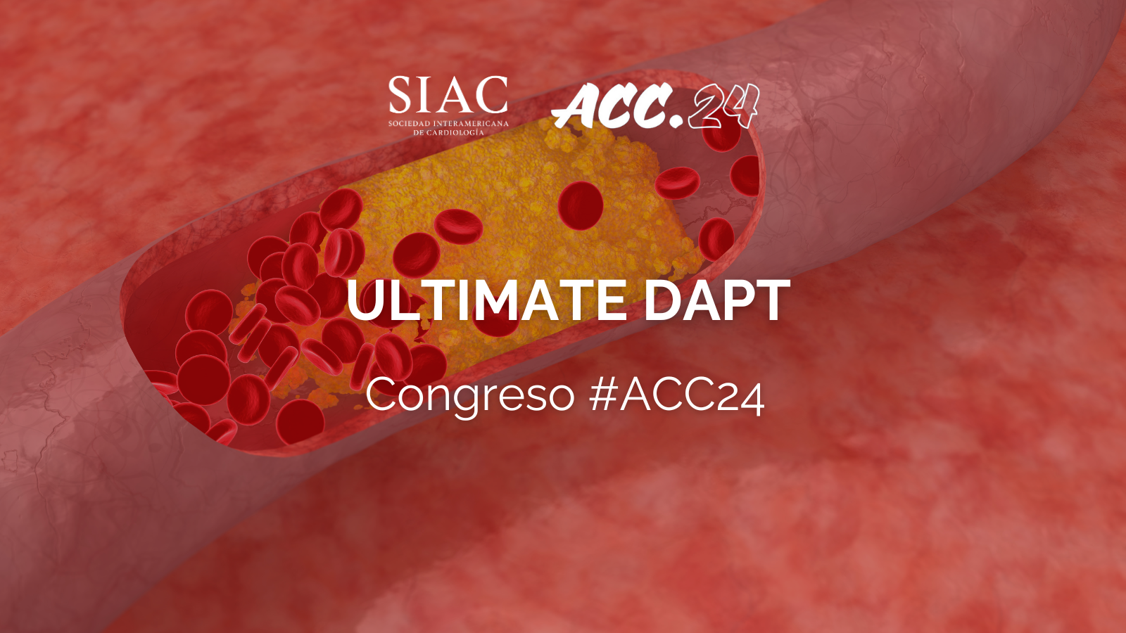 ULTIMATE DAPT: Ticagrelor monoterapia luego de 1 mes de DAPT – SIAC